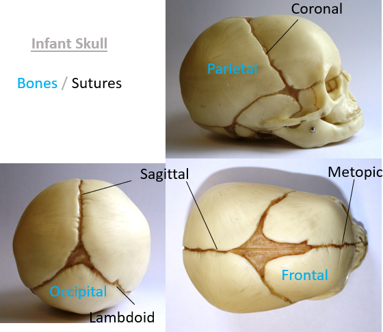 Cranial Sutures Figure 2 From Computerized Tomography Of Cranial